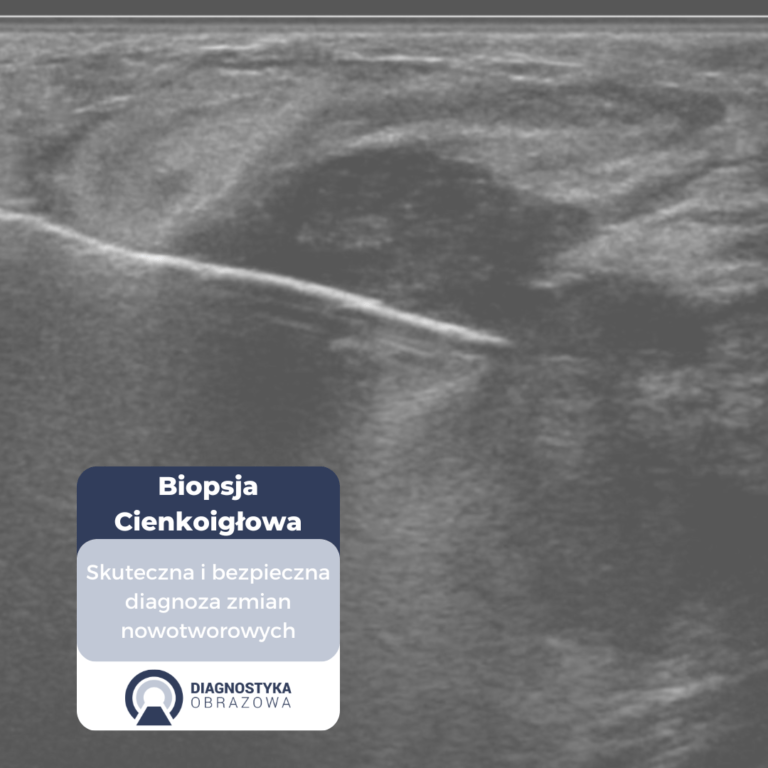 Biopsja Cienkoigłowa - Centrum Medyczne Diagnostyka Obrazowa